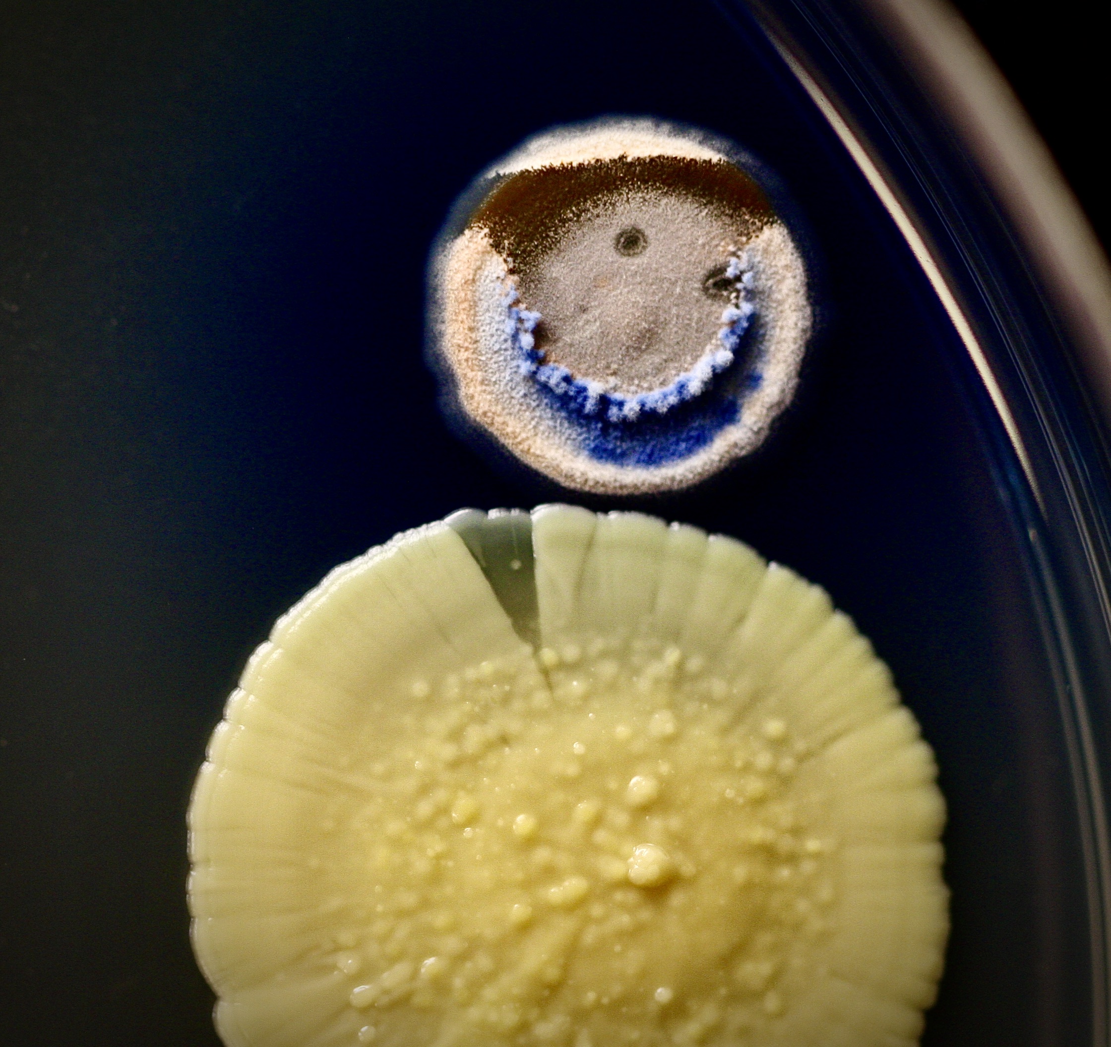 Mixed Cultures – Everything Microbiology