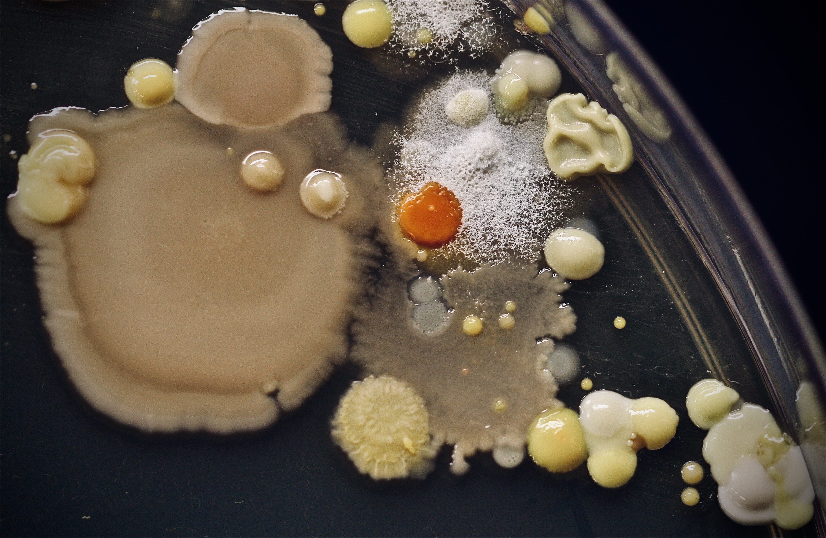 Mixed Cultures – Everything Microbiology